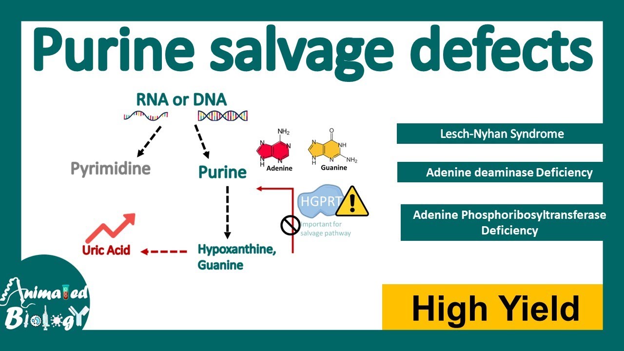 Purine Salvage Defects | Lesch-Nyhan Syndrome | Adenosine deaminase ...
