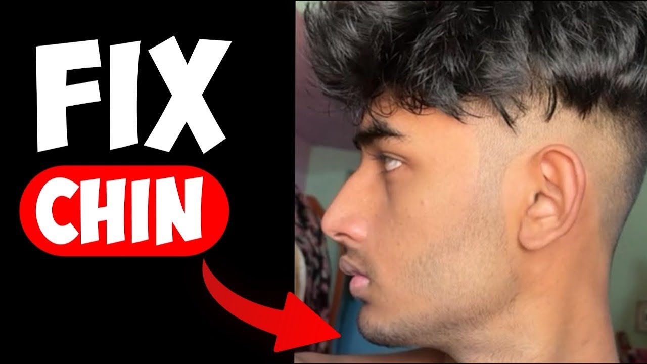 This is the only video you need to fix your chin - YouTube