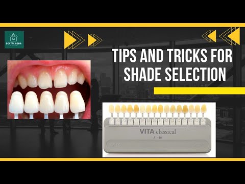 Shade Selection in Dentistry - YouTube