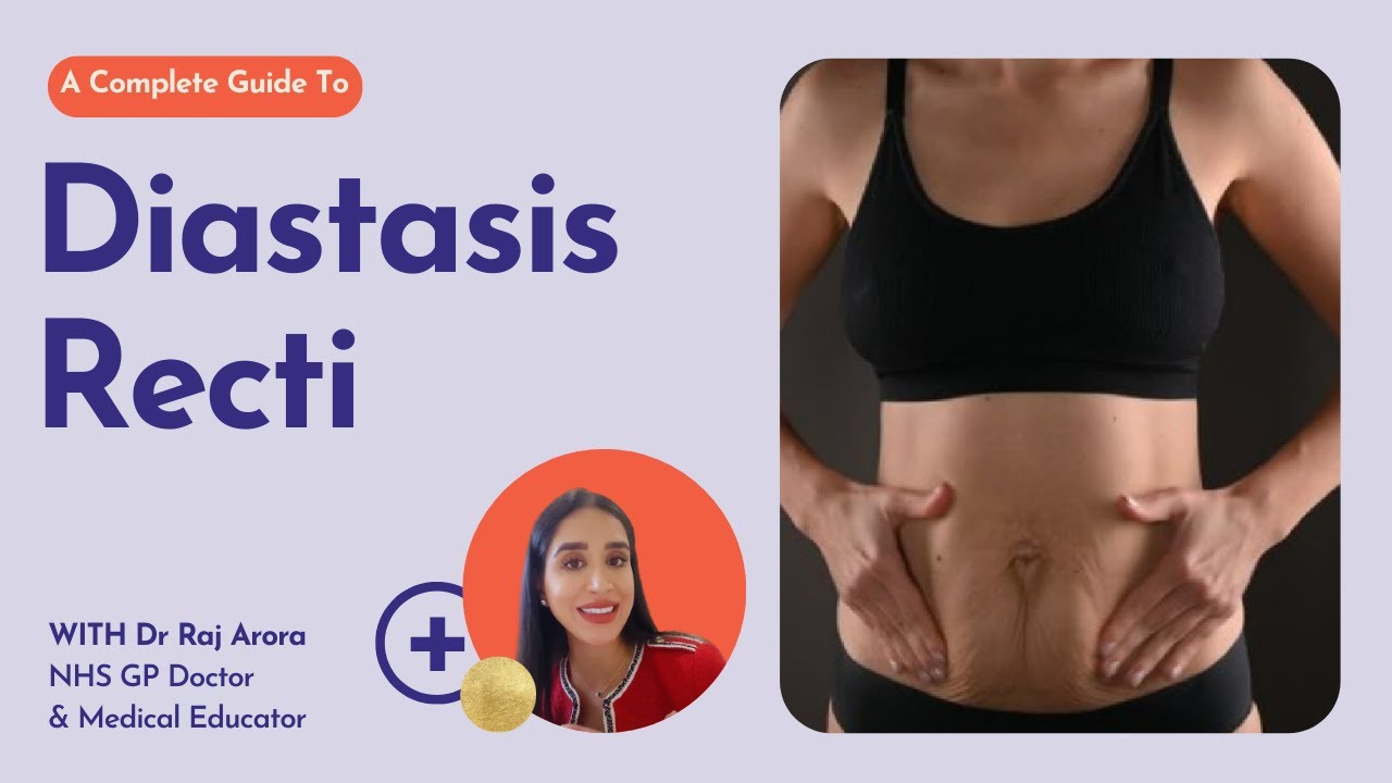 Diastasis Recti After Pregnancy: A Complete Healing Guide By Dr. Raj ...