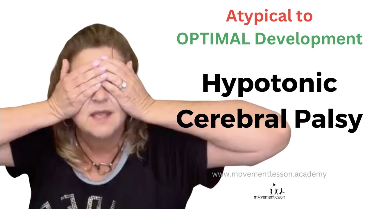 Atypical Development Baby Hypotonic Cerebral Palsy - YouTube