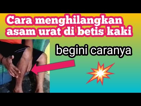 Cara menghilangkan asam urat di betis kaki - YouTube