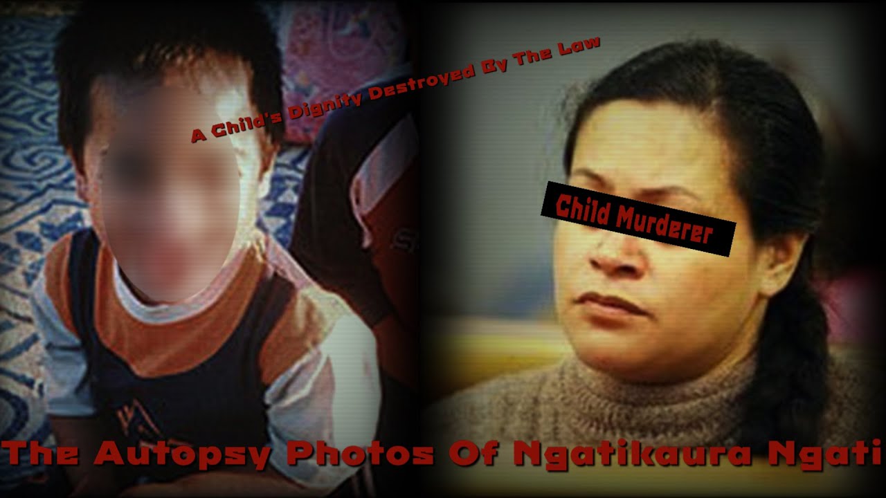 The Autopsy Photos Of Ngatikaura Ngati | A Childs Dignity Destroyed By ...