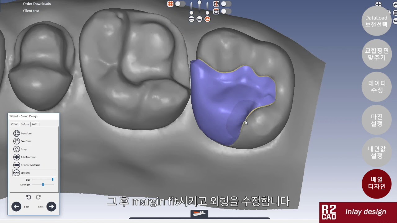 Inlay 영상 메뉴얼 - YouTube