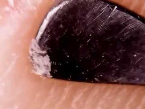 Toe Jam under high magnification - YouTube