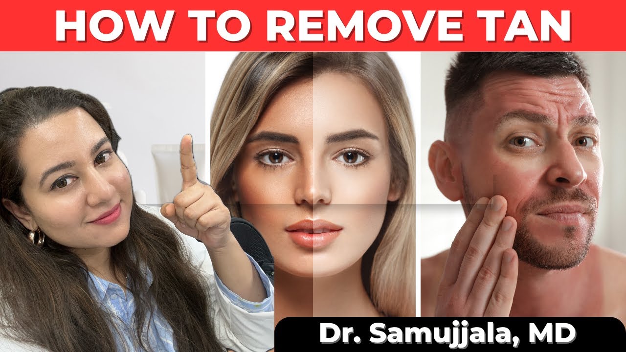BEGINNERS Guide to REMOVE TAN FAST!! स्किन टैनिंग कैसे जल्दी रिमूव करें ...