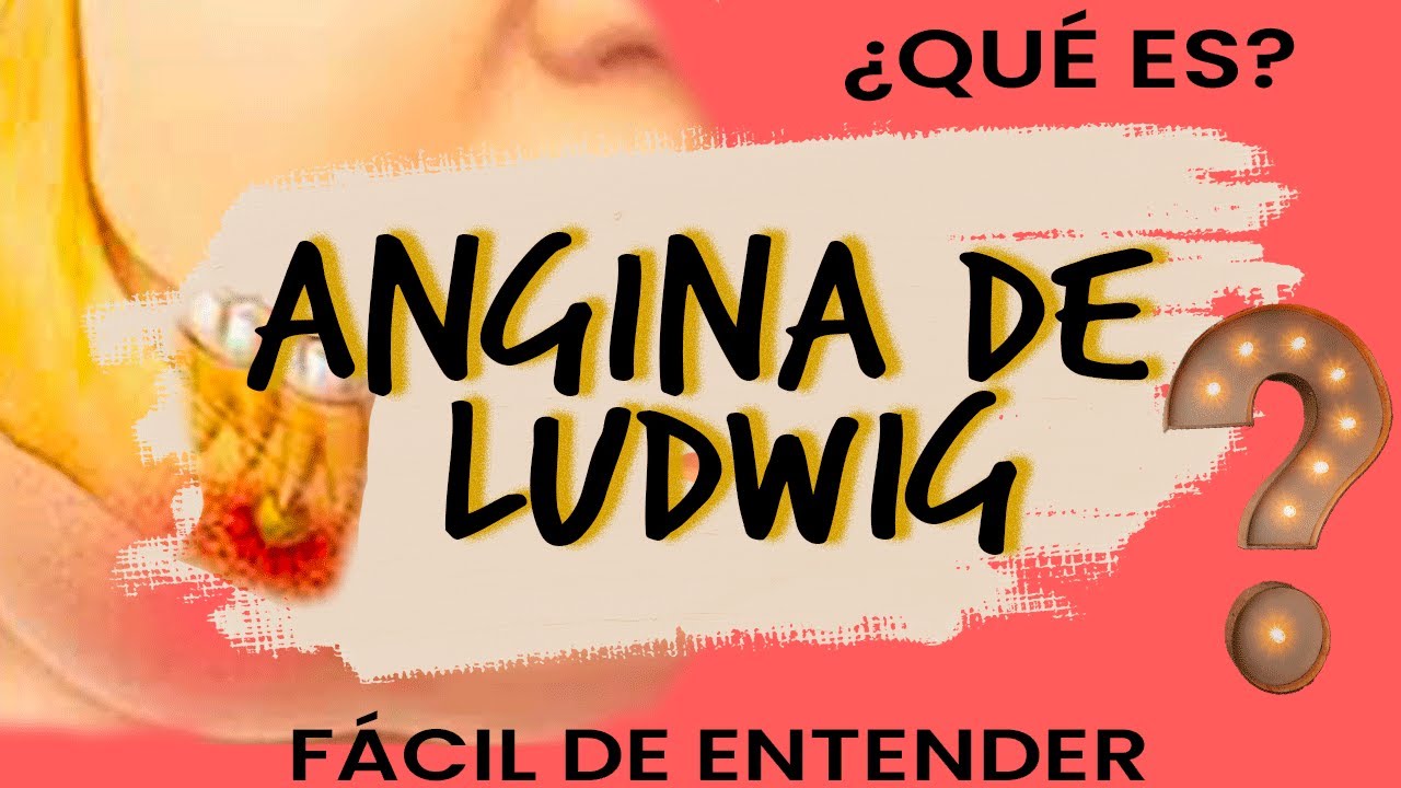 ¿Qué es la ANGINA de LUDWIG? / Fácil de Entender / Diagnóstico y ...
