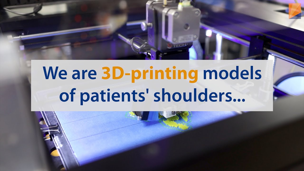 Advancing Complex Shoulder Surgeries with 3-D Printing - YouTube
