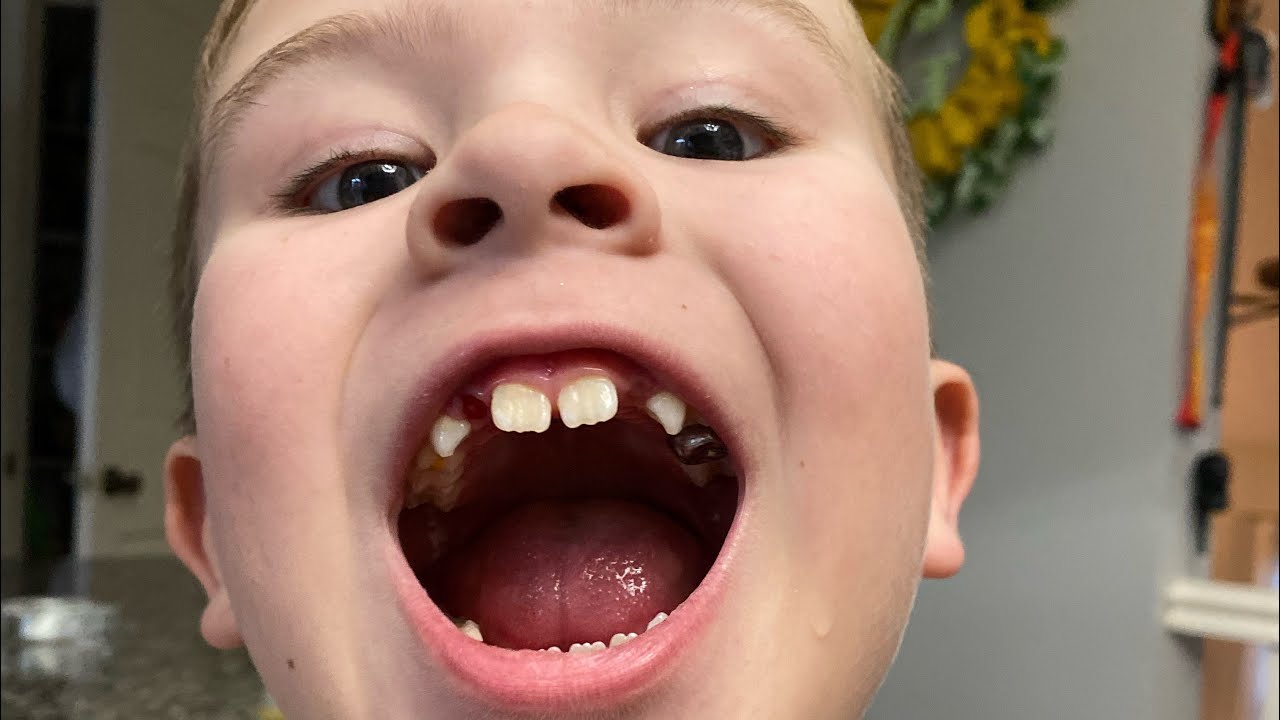 One Shot, One Tooth, One Brave Boy! - YouTube