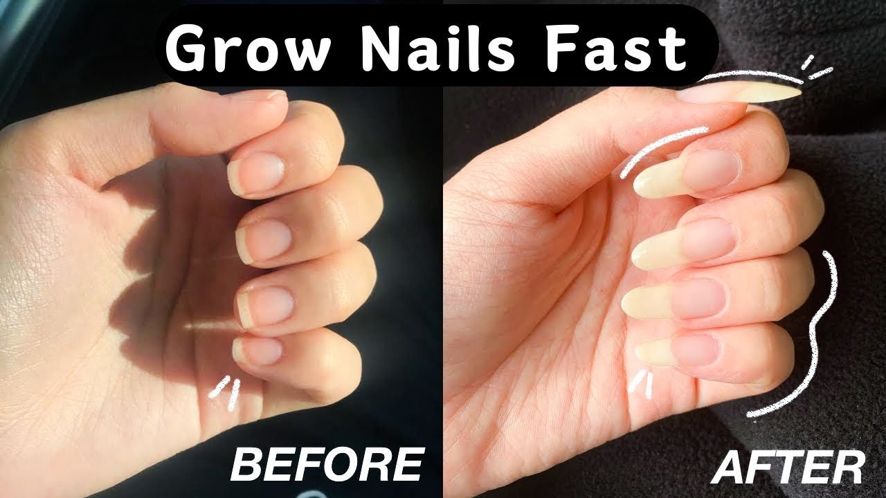 How To Grow Nails In 3 Days |100% WORKING 💅 - YouTube
