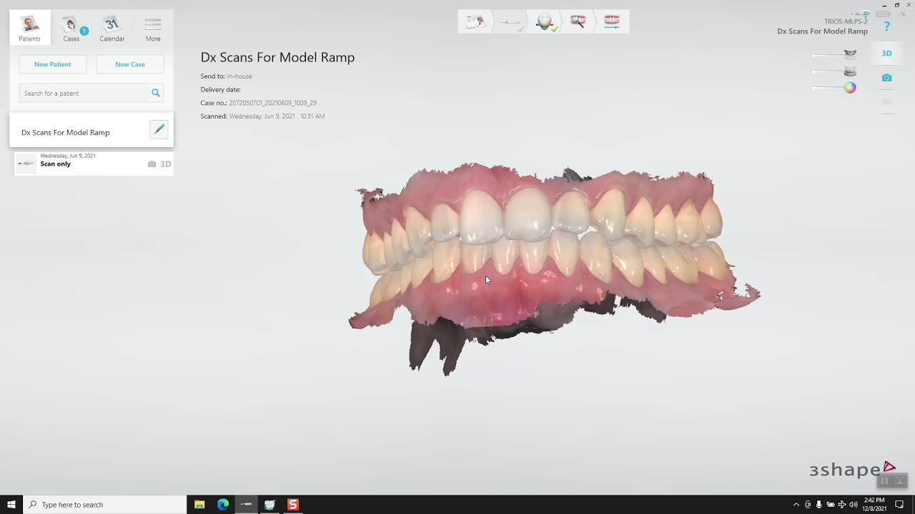 Making a Model from a Trios Scan for 3D Printing - YouTube