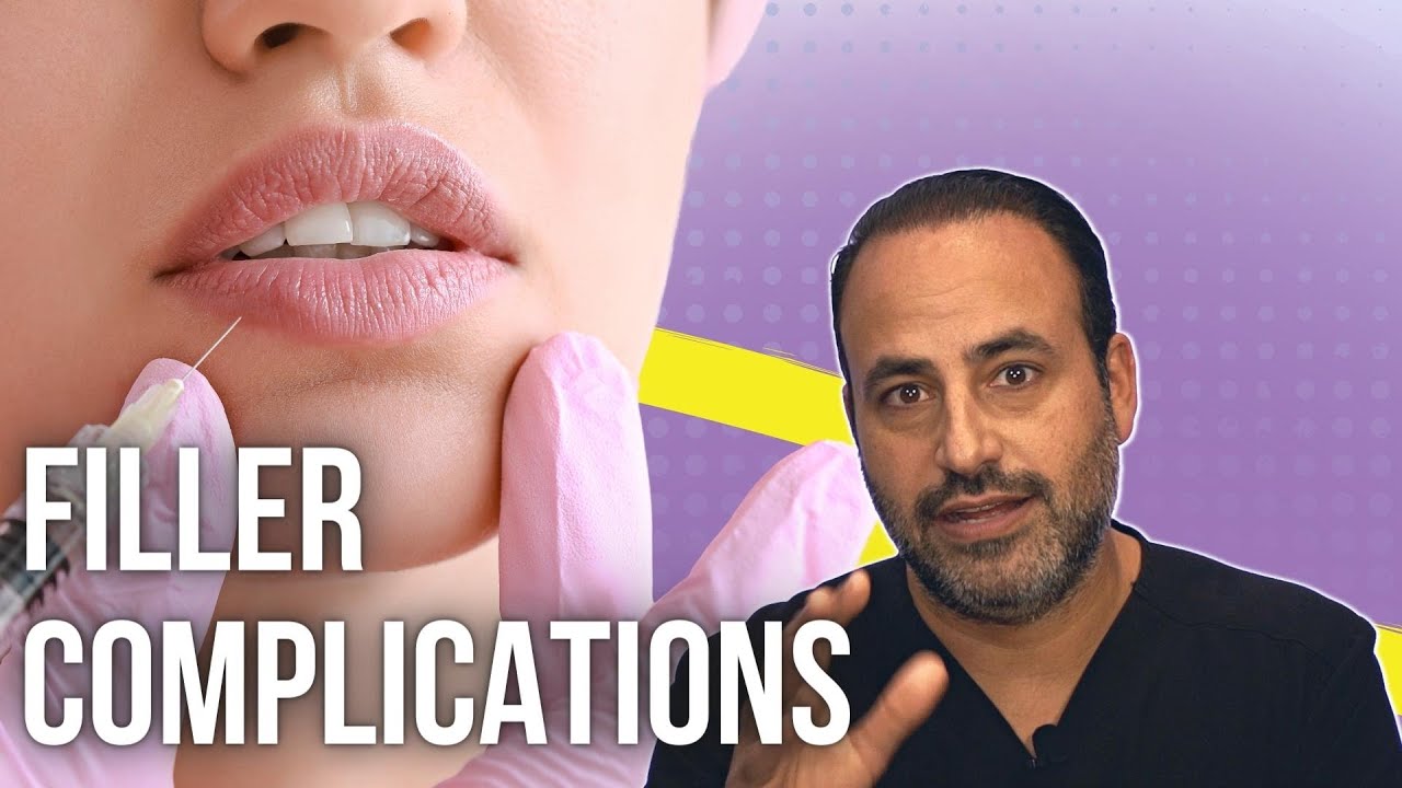 An Insight Into Filler Complications | Lesson of the Day - YouTube
