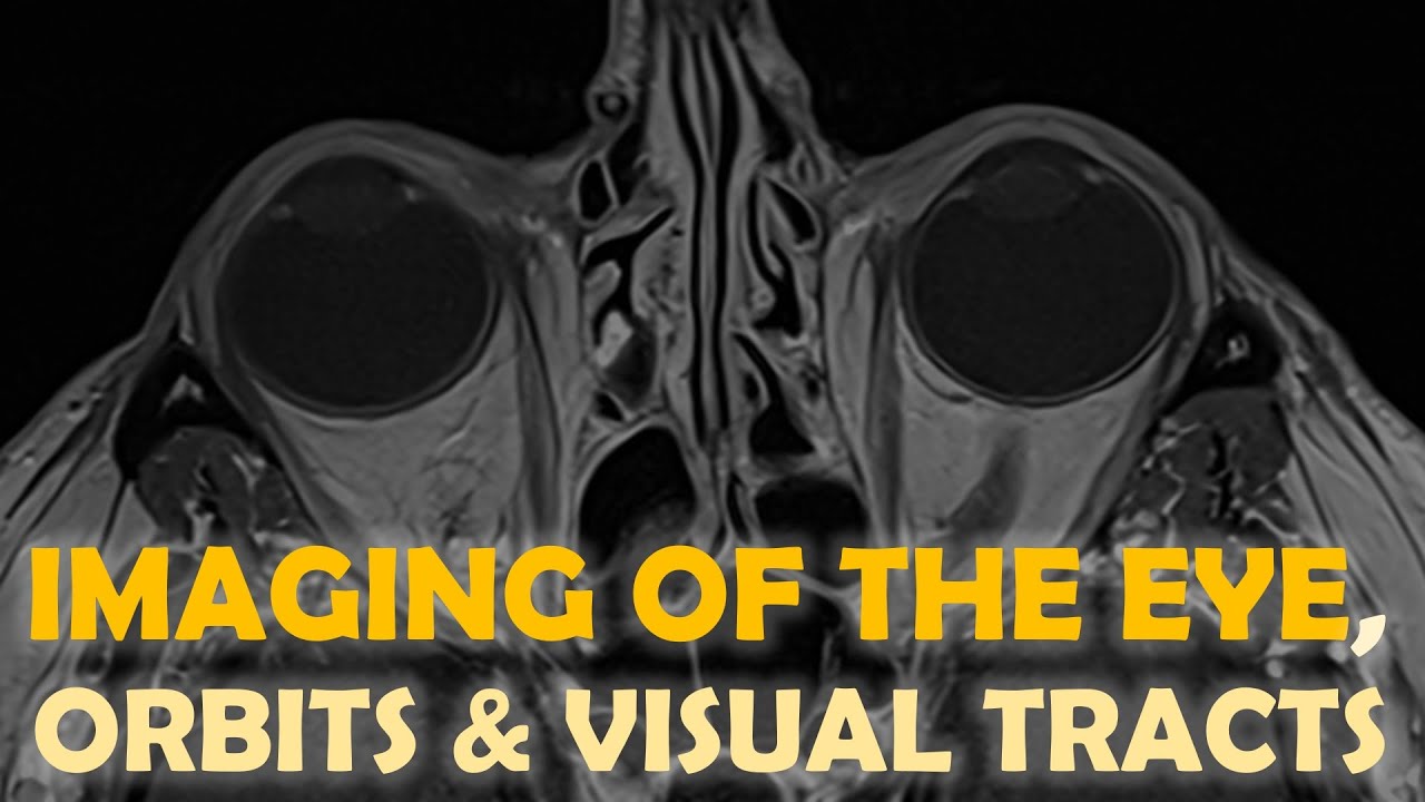 Imaging of the eye and visual system... more than meets the eye! - YouTube