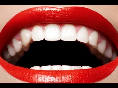 Best teeth whitening strips for home use by Stella White
