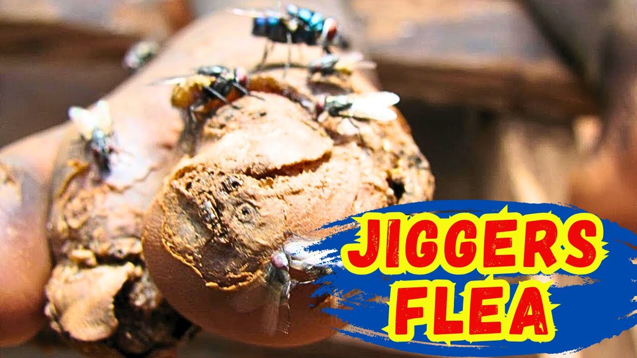 There's a Reason They Call It the "Flea of Doom" | JIGGER FLEA. - YouTube