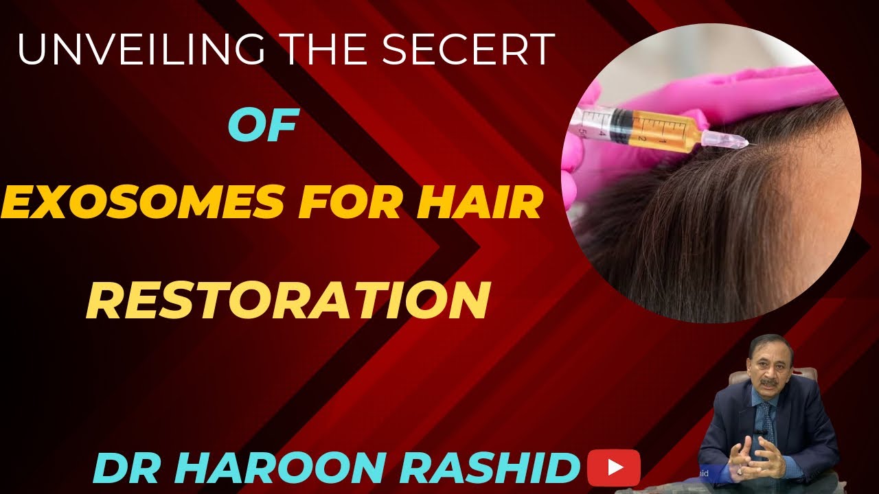 Unveiling the secert of exosomes for hair restoration]]new video by Dr ...