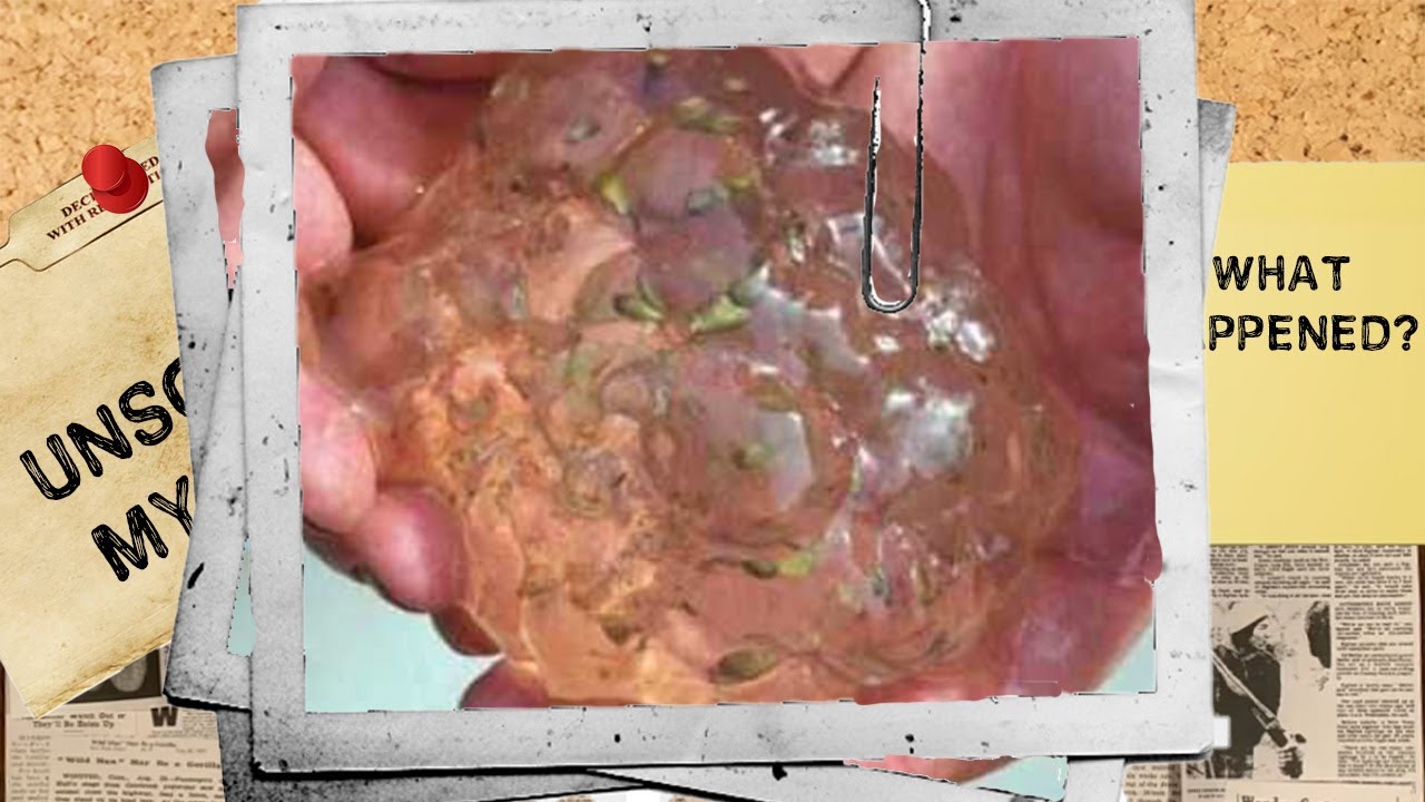 The Day it Rained Jelly: Solving the Oakville Blob Mystery - YouTube