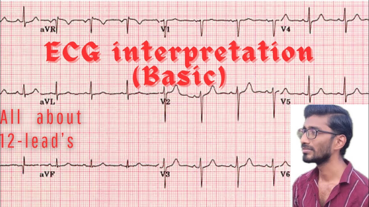 ECG Basics ll ECG made easy - YouTube