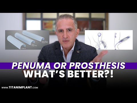 Penuma or Penile Prosthesis? - Which One Is Better For YOU? Dr. Taj Explains