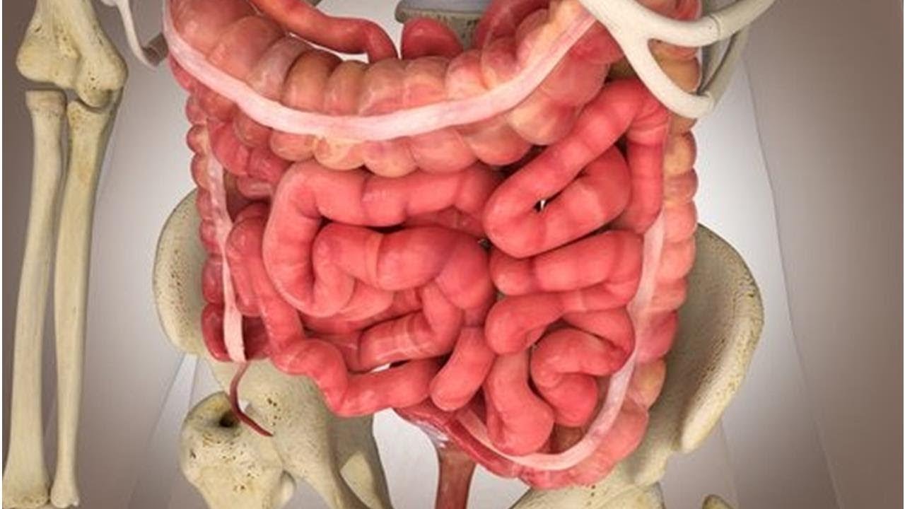 Infarto intestinal mesentérico: exámenes y tratamientos | Maha TV - YouTube
