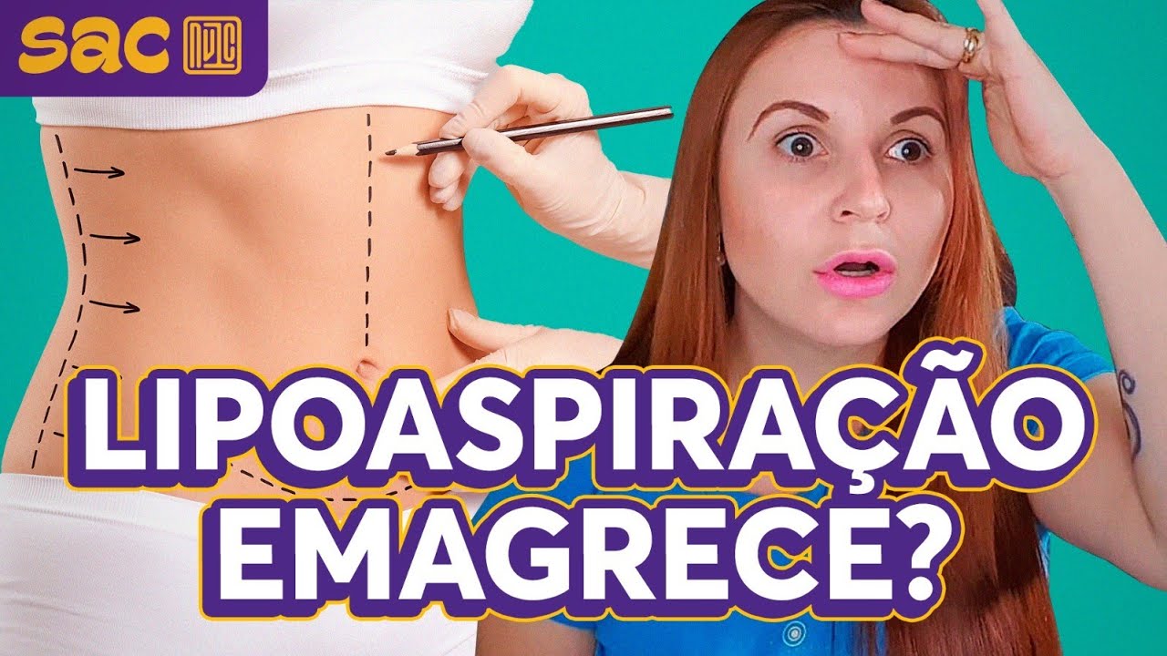 Quem faz lipo emagrece? - YouTube