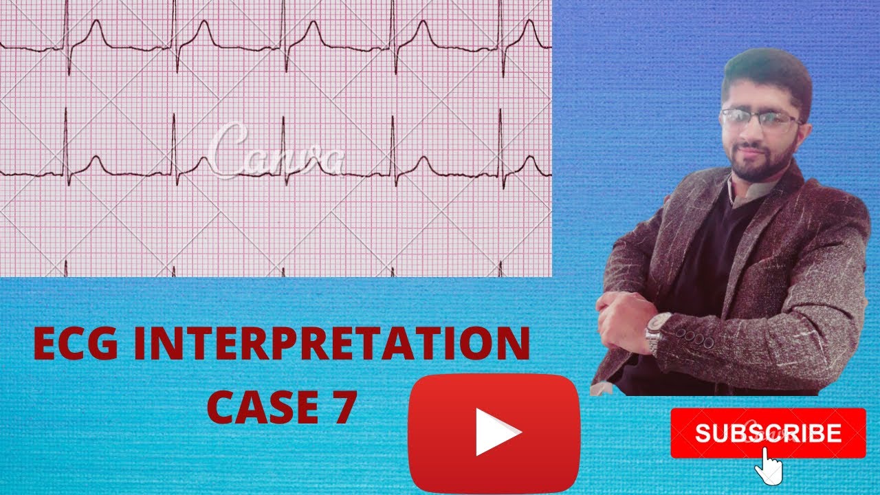 ECG INTERPRETATION CASE 7| EKG| EDUCATIONAL VIDEO - YouTube