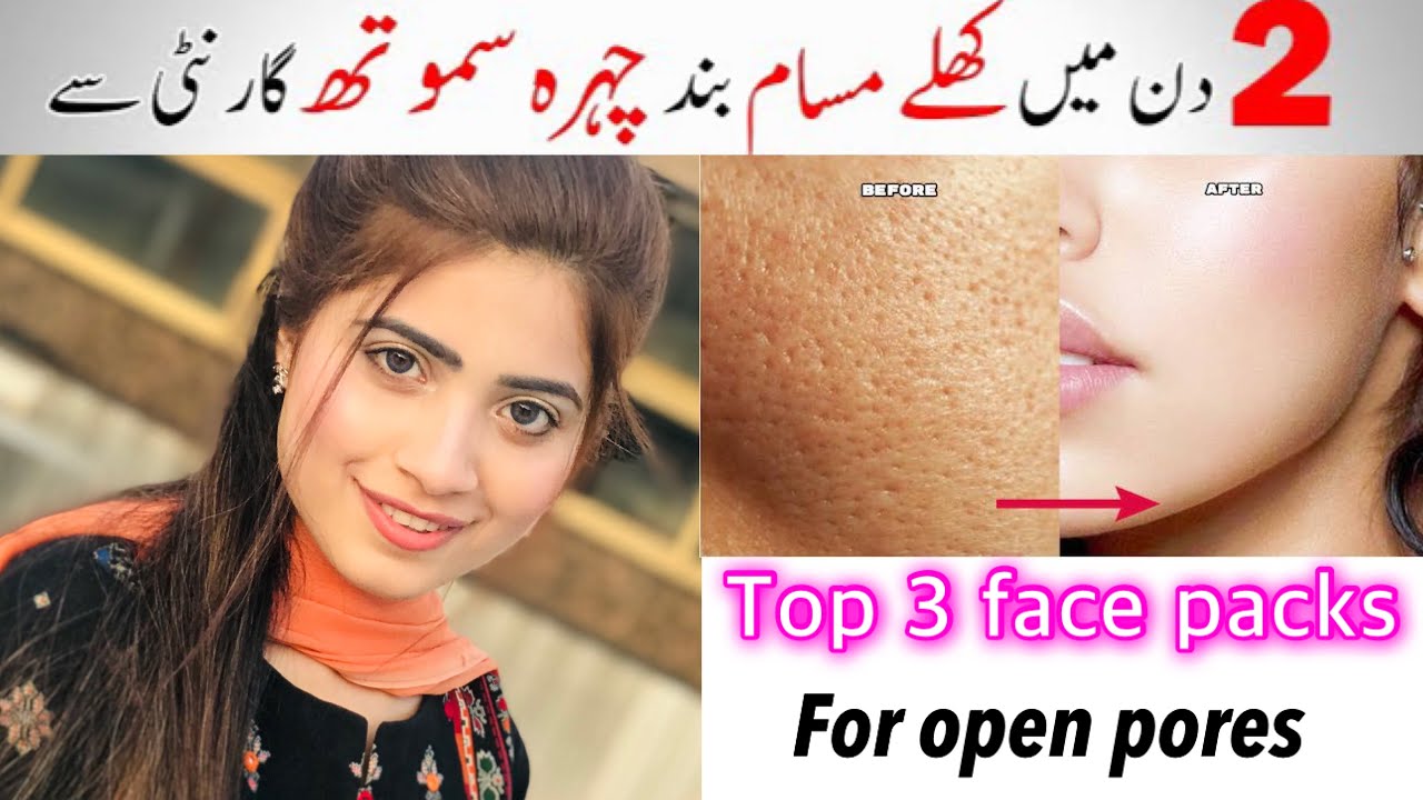 How to reduce open pores on face| open pores ka ilaj in Urdu/Hindi ...