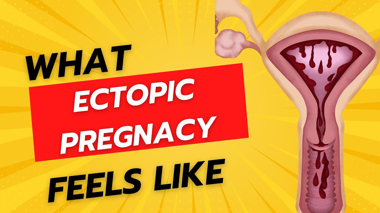 What are the early signs of an ectopic pregnancy? normal pregnancy pain ...