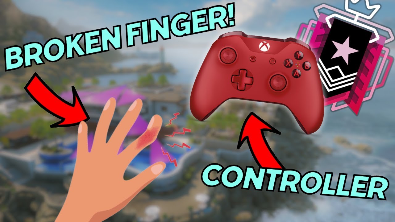 Playing R6 On *CONTROLLER* With A *BROKEN FINGER*! - YouTube