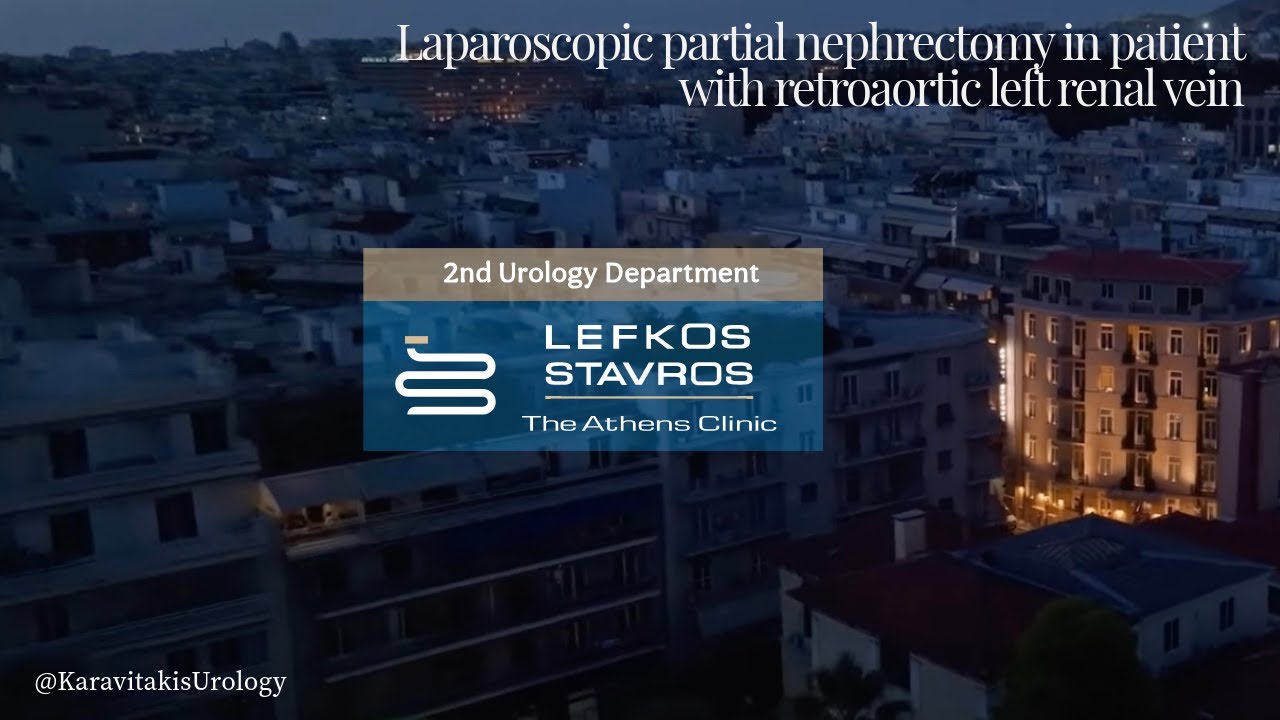 Laparoscopic partial nephrectomy in patient with retroaortic left renal ...