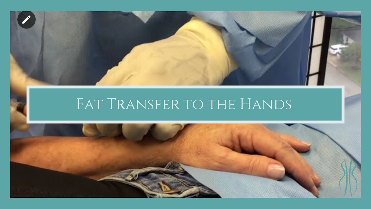 Fat Transfer to the Hands - YouTube
