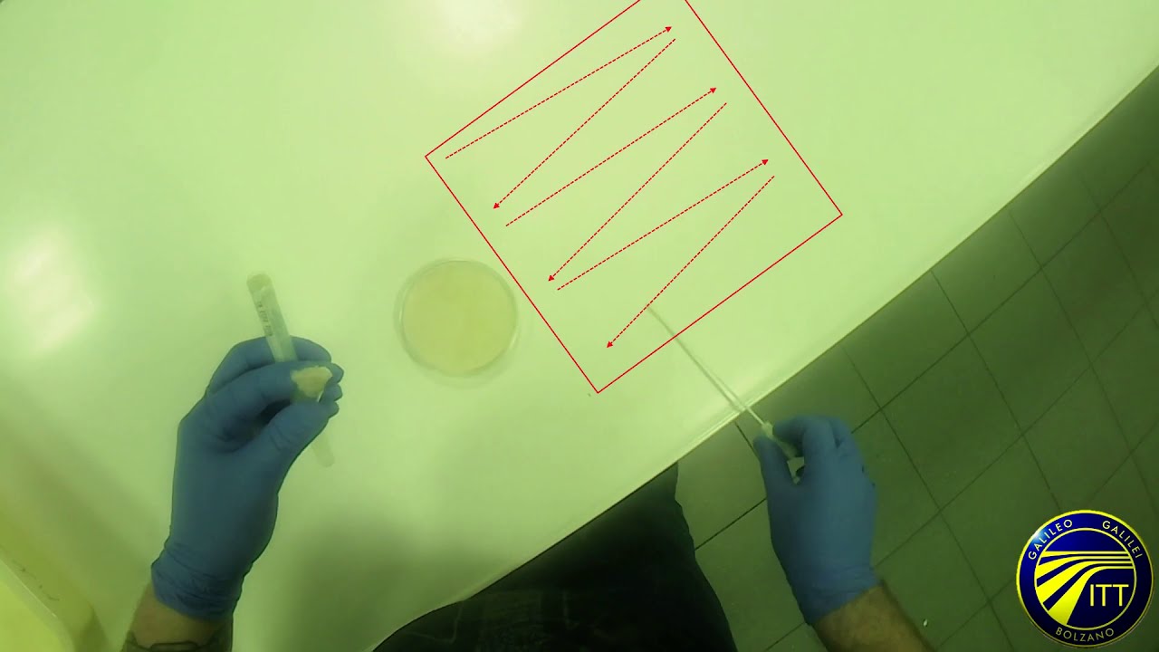 Semina per striscio (tampone su superficie) - Corso di microbiologia ...