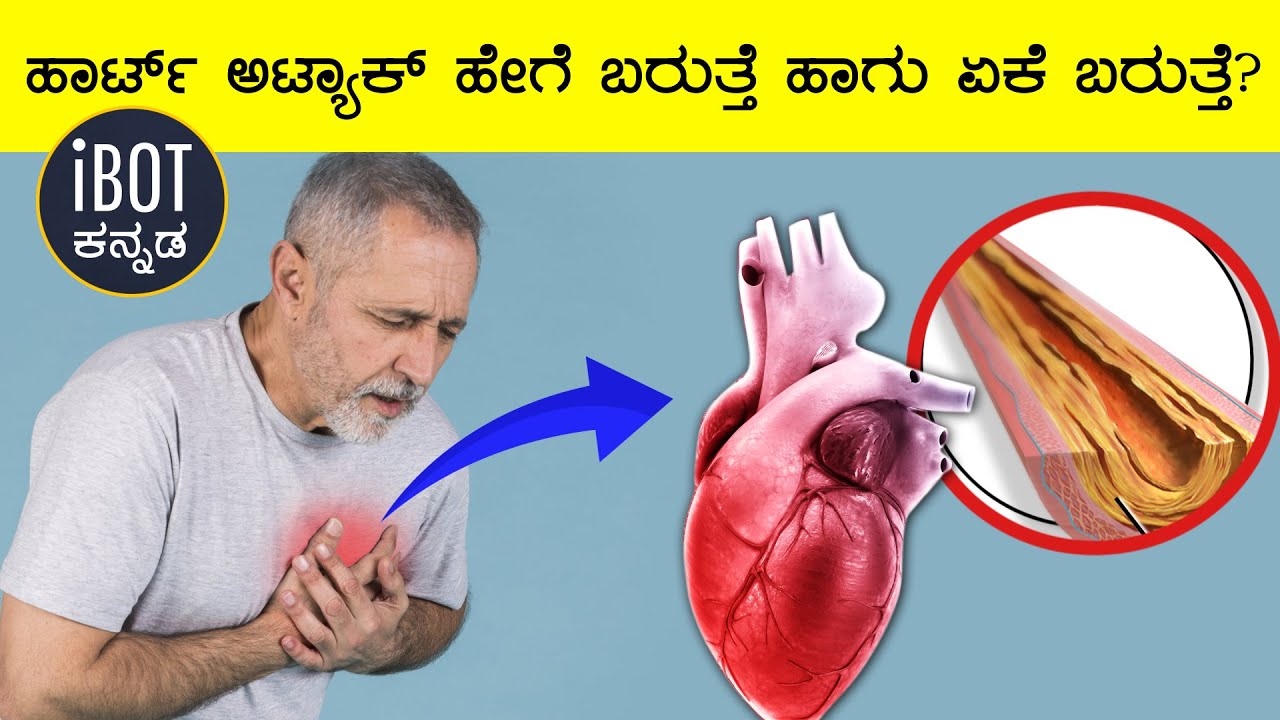 "HEART ATTACK" causes and its side effects | ಹಾರ್ಟ್ ಅಟ್ಯಾಕ್ ಮುನ್ಸೂಚನೆ ...