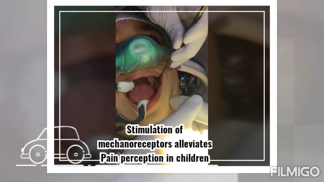 Innovative ways to Minimise pain of injection in children's dentistry ...