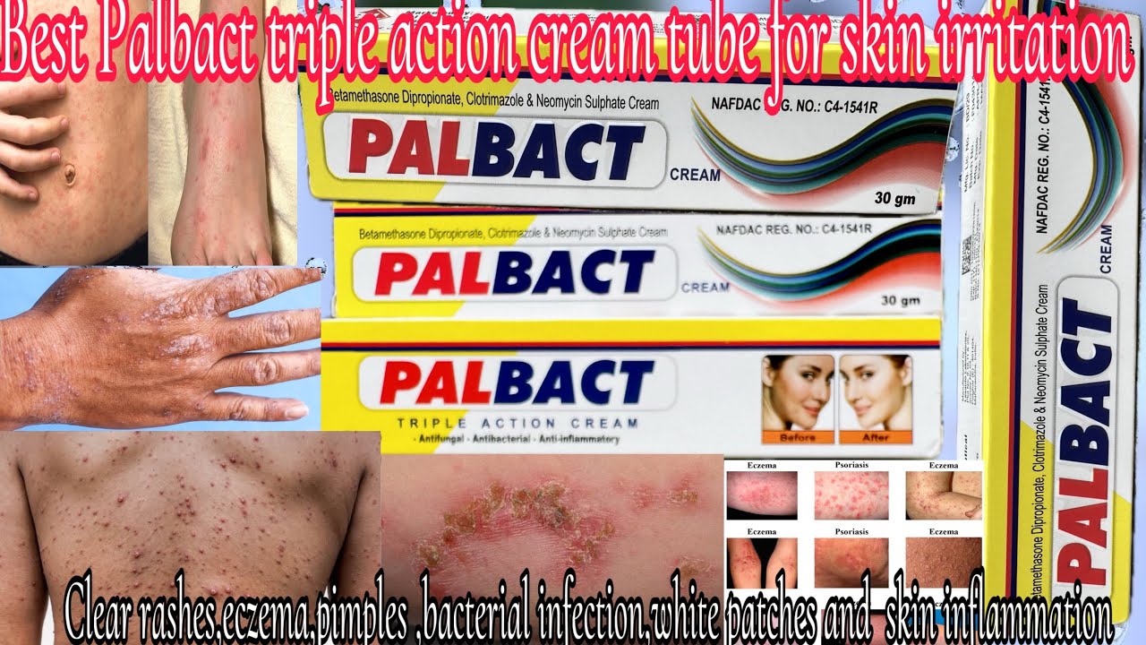 PALBACT TRIPLE ACTION CREAM TUBE FOR SKIN REACTIONS,TREATS EZECMA ...