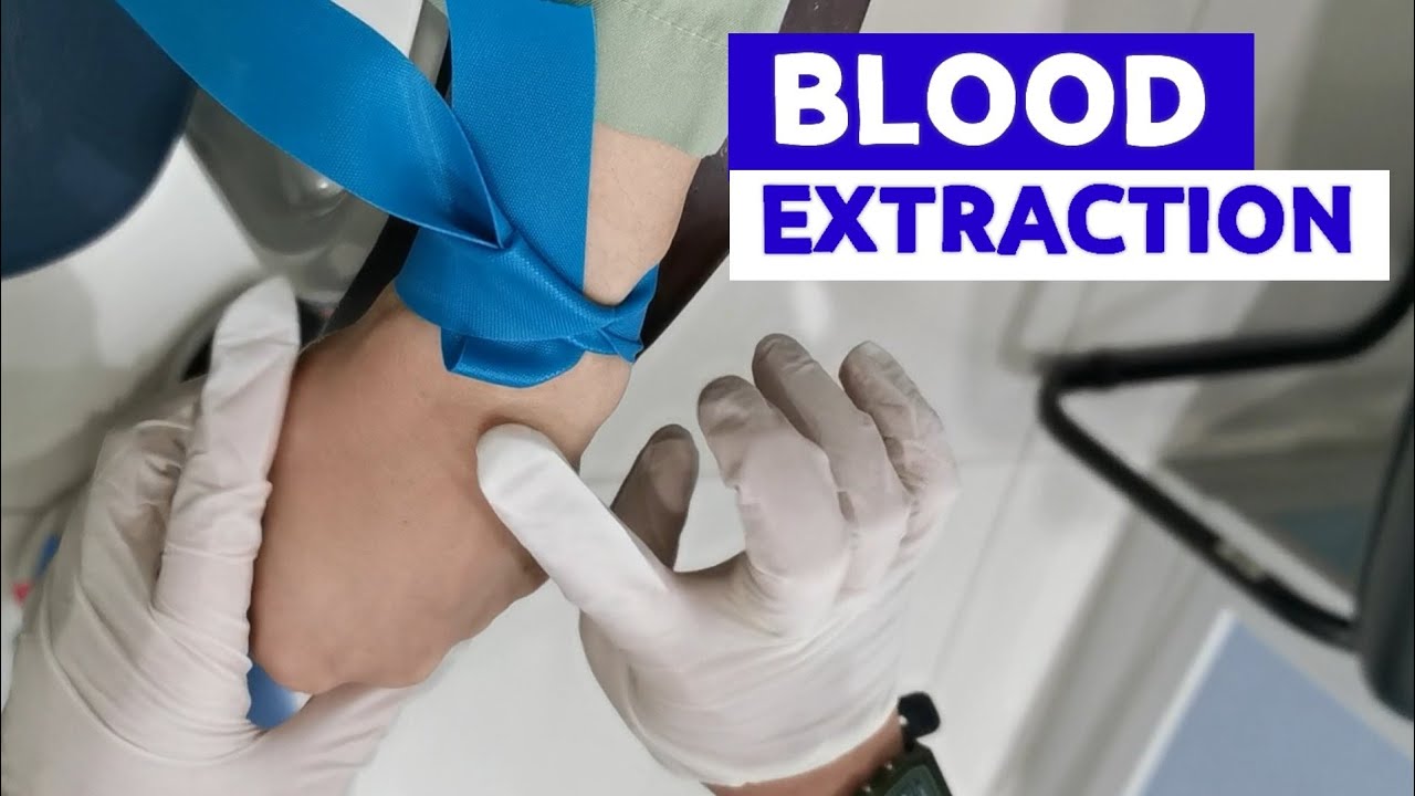 Blood Extraction Using Butterfly Needle Infusion Set and Syringe ...