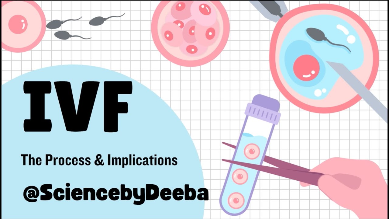 How does In Vitro Fertilisation (IVF)work step-by-stepExplanation ...
