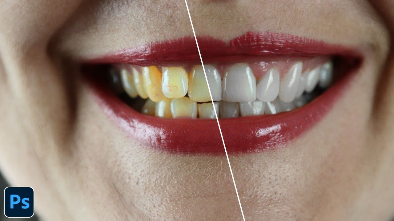 How to Transform Yellow Teeth into White and Bright in Photoshop - YouTube