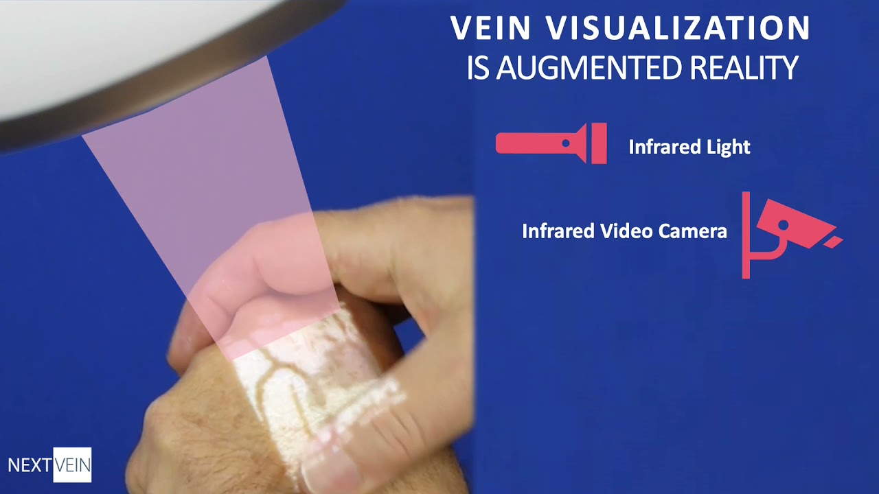 How Does Vein Visualization Work? - YouTube