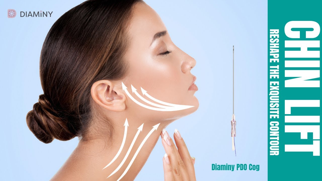 Do you know what the double chin lift procedure is? Cheek lift, foxeye ...