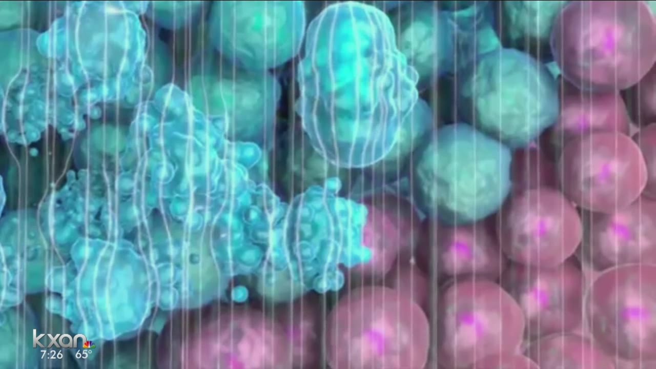 Novocure Device - YouTube