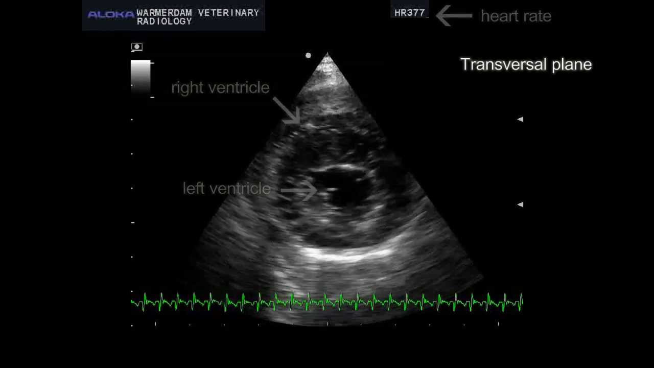 Supraventricular tachycardia in a dog - Supraventriculaire tachycardie ...