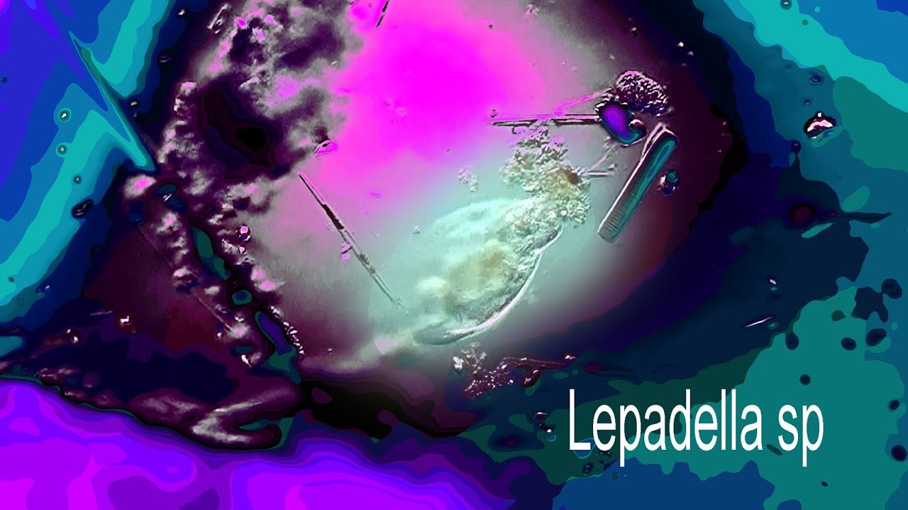 Lepadella sp - YouTube