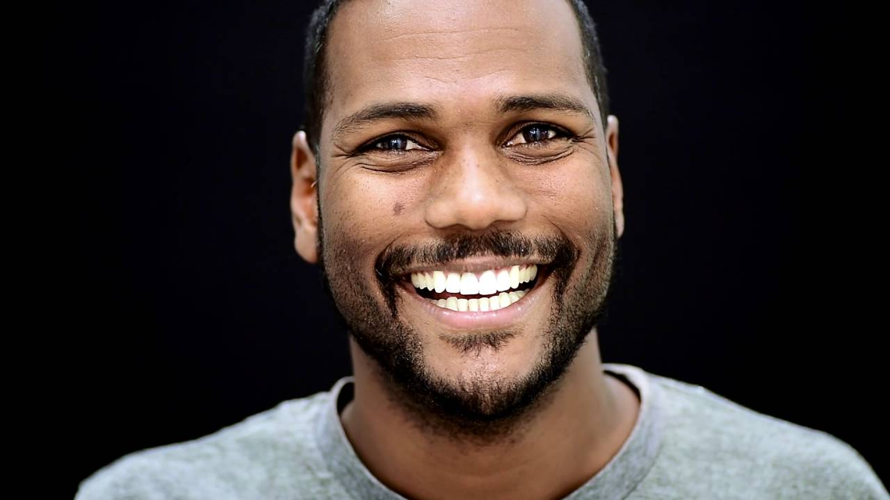 Six Month Smiles Review: Craig - YouTube