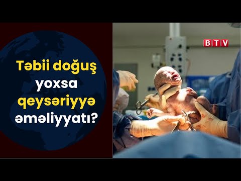 Təbii doğuş yoxsa qeysəriyyə əməliyyatı? | BTV XƏBƏR