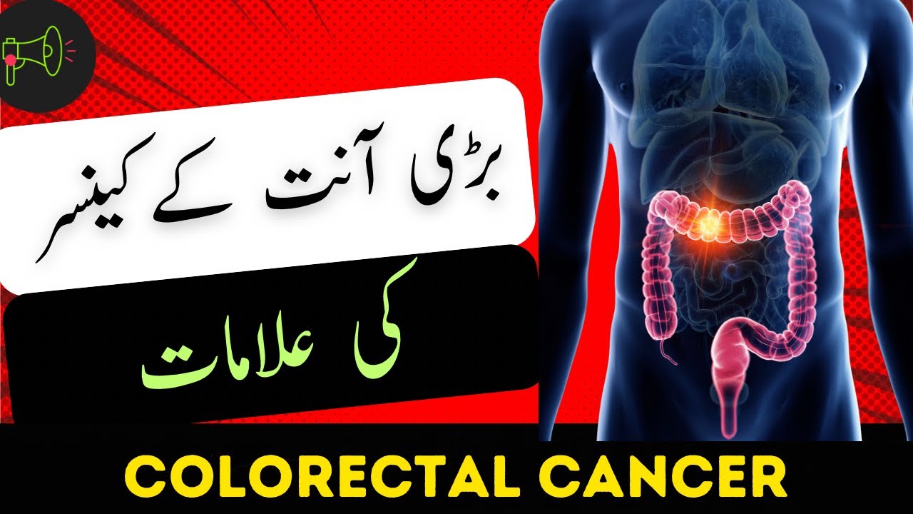 Colon Cancer Symptoms | Bari Aant K Cancer Ki Alamaat| Stool k Sath ...
