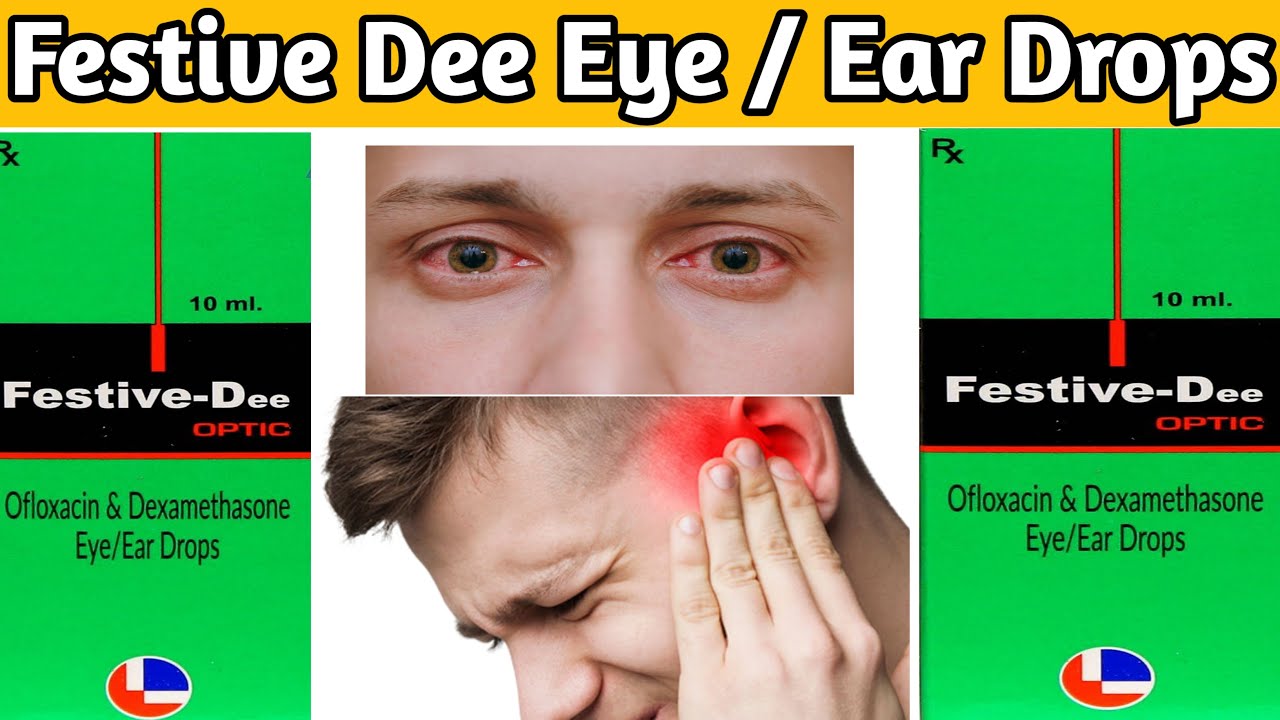 festive dee | festive dee optic eye/ear drops /ofloxacin dexamethasone ...