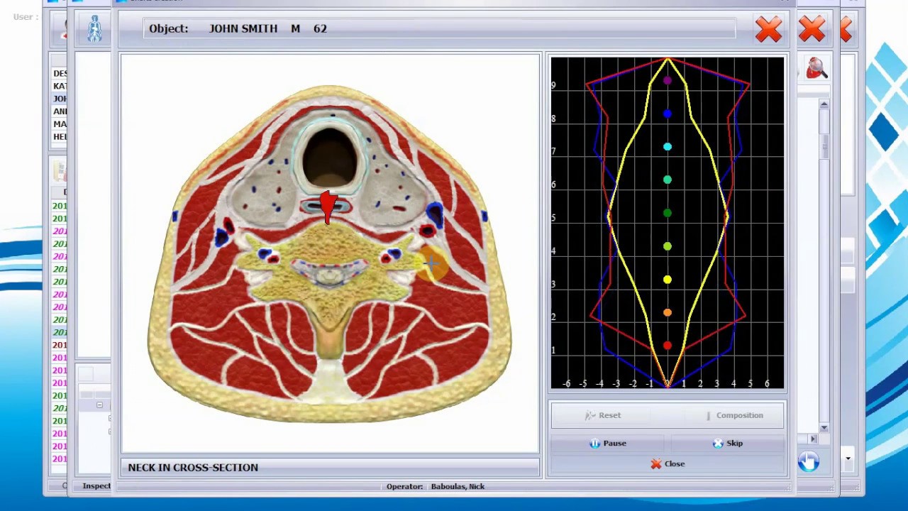 SENSITIV IMAGO BIORESONANCE SCAN PART 9C: BRT Summarized and What you ...
