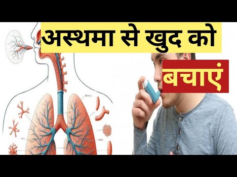 Full information about ASHTHAMA.Causes and symptoms of ASHTHAMA. - YouTube