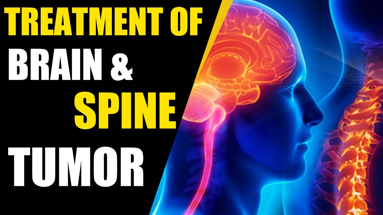 Types of spinal tumor | What Are the Types of Spinal Cord Tumors? | Dr ...